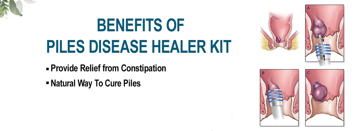 Piles Disease Healer Kit – Ayurvedayogashram
