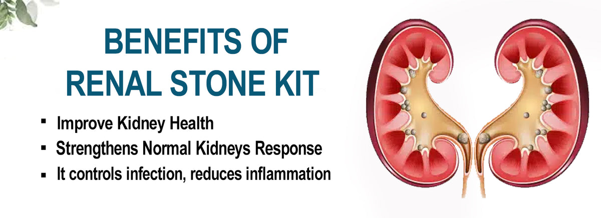 Renal Stones Kit – Ayurvedayogashram